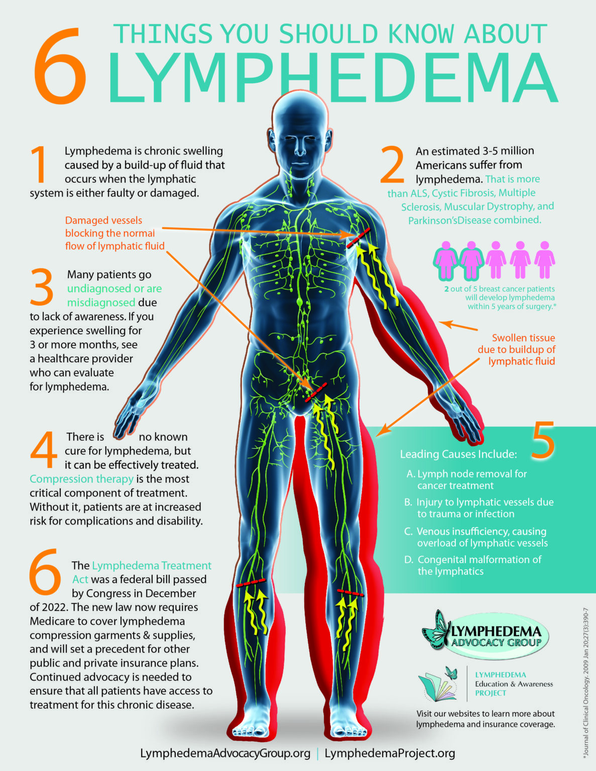 Educational Materials | The Lymphedema Advocacy Group